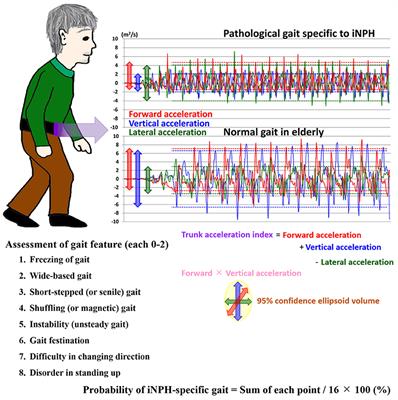 Gait Abnormality Rating Scale