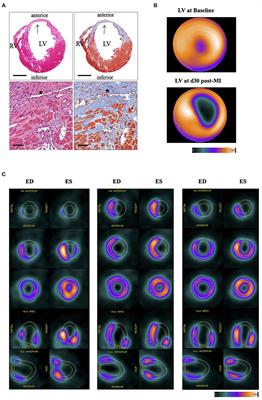 Frontiers | Cardiac 18F-FDG Positron Emission Tomography: An Accurate ...
