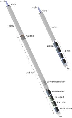 Frontiers | Early Deformation of Deep Brain Stimulation Electrodes ...