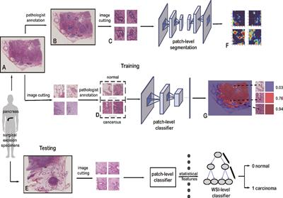 Frontiers | Automatic Pancreatic Ductal Adenocarcinoma Detection in ...