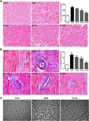 Frontiers | Effects of Sodium Ferulate on Cardiac Hypertrophy Are via ...