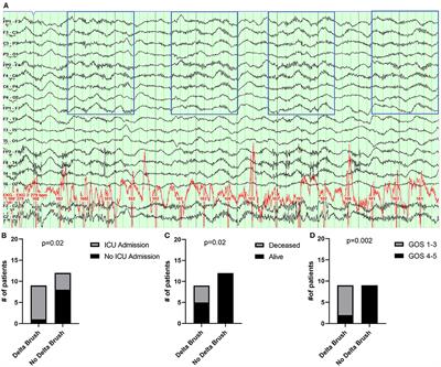 Frontiers | Extreme Delta Brush in Anti-NMDAR Encephalitis Correlates ...