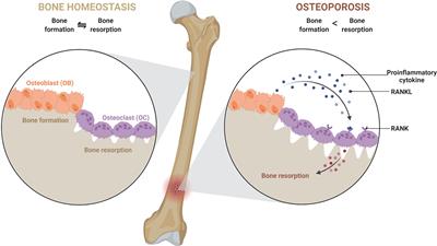 Frontiers | Immunoporosis: Role of Innate Immune Cells in Osteoporosis