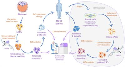 Frontiers | Monogenic Diabetes Modeling: In Vitro Pancreatic ...