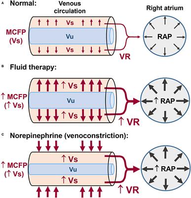 Frontiers | Clinical Application of the Fluid Challenge Approach in ...