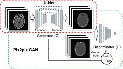 Frontiers | MRI-Only Radiotherapy Planning for Nasopharyngeal Carcinoma ...