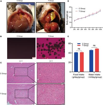 Frontiers | Changes and Correlations of the Intestinal Flora and Liver ...