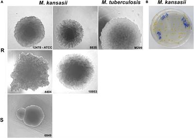 Frontiers | A Murine Model of Mycobacterium kansasii Infection ...