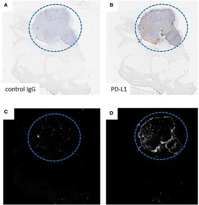 Frontiers | Digital Quantification of Tumor PD-L1 Predicts Outcome of ...