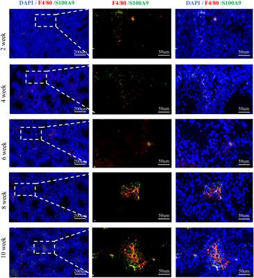 Frontiers | S100A9 Activates the Immunosuppressive Switch Through the ...