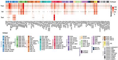 Frontiers | Development of a Machine Learning Classifier for Brain ...