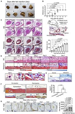 Frontiers | Unique Angiogenesis From Cardiac Arterioles During ...
