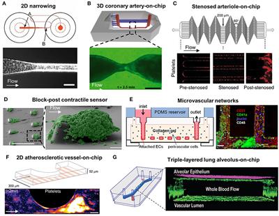 Frontiers | Emerging Microfluidic Approaches for Platelet ...