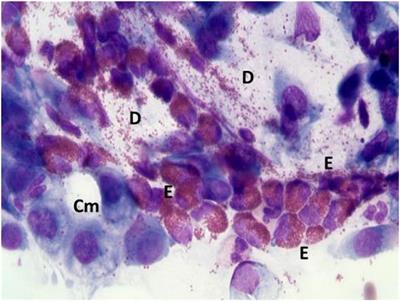 Frontiers | Nasal Cytology: A Easy Diagnostic Tool in Precision ...