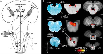 Frontiers | Supraspinal Mechanisms Underlying Ocular Pain