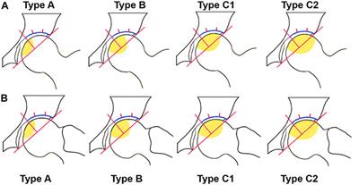 Frontiers | The Therapeutic Effect of Huo Xue Tong Luo Capsules in ...