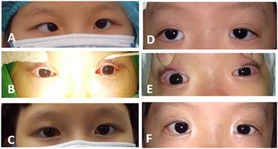 Frontiers | A Novel Method Ensuring an Immediate Target Angle After ...