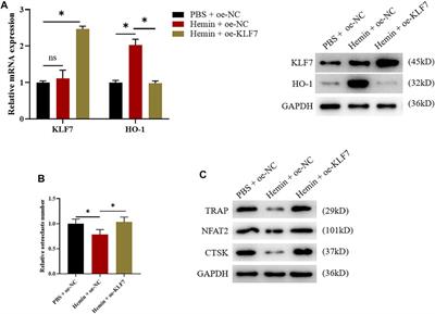 Frontiers | Transcription Factor KLF7 Promotes Osteoclast ...