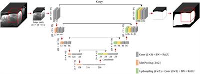 Frontiers | 3D U-Net Improves Automatic Brain Extraction for Isotropic ...
