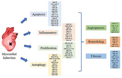 Acute Myocardial Infarction Pathophysiology