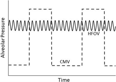 Frontiers | The Physiological Basis of High-Frequency Oscillatory ...