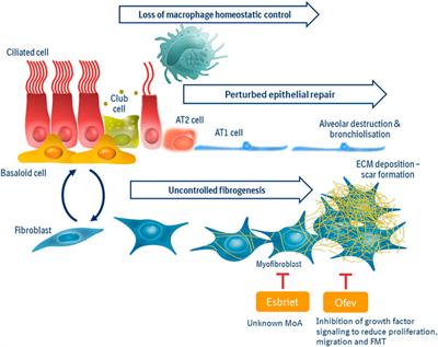 Frontiers | Challenges for Clinical Drug Development in Pulmonary Fibrosis