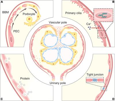Frontiers | The Role of Parietal Epithelial Cells in the Pathogenesis ...