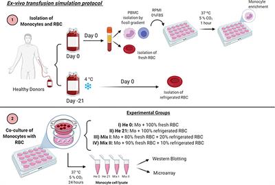 Frontiers | Extracellular Vesicles From Stored Red Blood Cells Convey ...