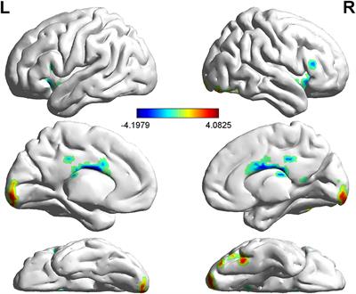 Frontiers | Altered Spontaneous Brain Activity in Left-Behind Children ...