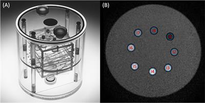Frontiers | Synthetic MRI for Radiotherapy Planning for Brain and ...