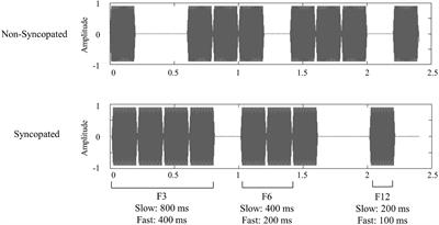 Frontiers | Aging effects on neural processing of rhythm and meter