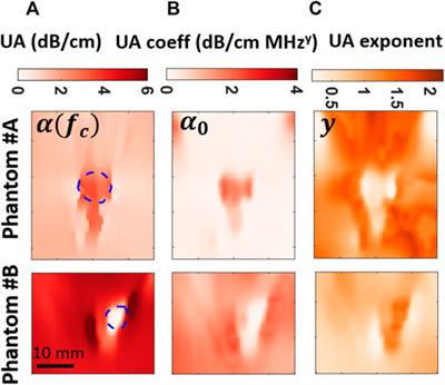 Frontiers | Spectral Ultrasound Imaging of Speed-of-Sound and ...