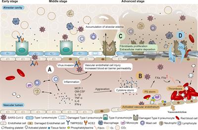 Frontiers | Persistent Lung Injury and Prothrombotic State in Long COVID