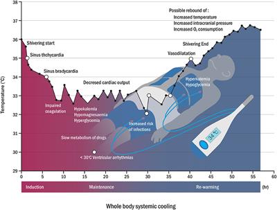 Frontiers | Selective Brain Cooling: A New Horizon of Neuroprotection