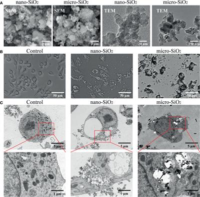 Frontiers | Acute Silica Exposure Triggers Pulmonary Inflammation ...