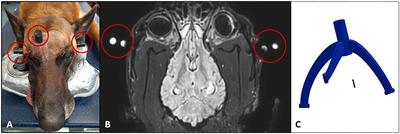 Frontiers | Case Report: Clinical Use of a Patient-Individual Magnetic ...