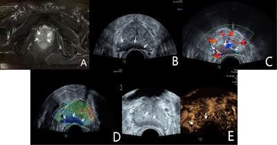 Frontiers | Application of Multiple Ultrasonic Techniques in the ...