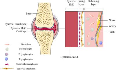 Frontiers | Synovial Macrophages: Past Life, Current Situation, and ...