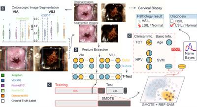 Frontiers | Computer-aided diagnosis of cervical dysplasia using ...