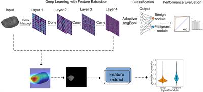 Frontiers | Ultrasound Image Classification of Thyroid Nodules Based on ...