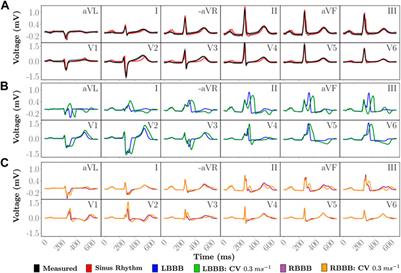 Frontiers | A personalized real-time virtual model of whole heart ...