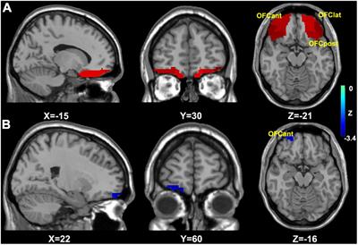 Frontiers | Orbitofrontal Cortex Functional Connectivity-Based ...