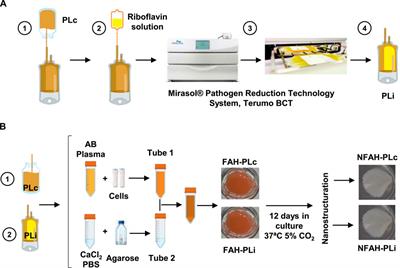 Frontiers | Inactivation of human plasma alters the structure and ...