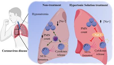 Frontiers | Hypertonic Solution in Severe COVID-19 Patient: A Potential ...
