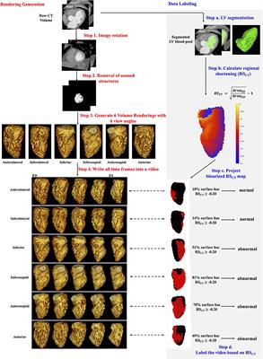 Frontiers | Detection of left ventricular wall motion abnormalities ...