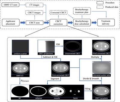 Frontiers | Development and validation of a scatter-corrected CBCT ...