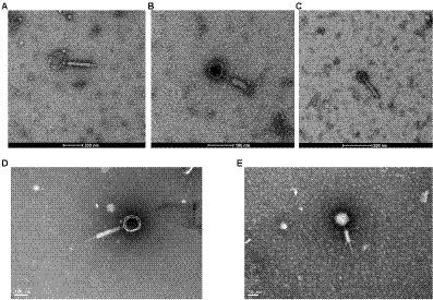 Frontiers | Isolation and characterization of novel Fusobacterium ...