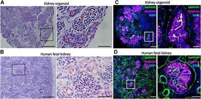 Frontiers | Assessing kidney development and disease using kidney ...