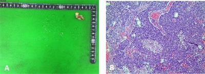 Frontiers | Case report: Strategies for improving outcomes in patients ...