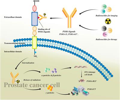 Frontiers | Current role of prostate-specific membrane antigen-based ...